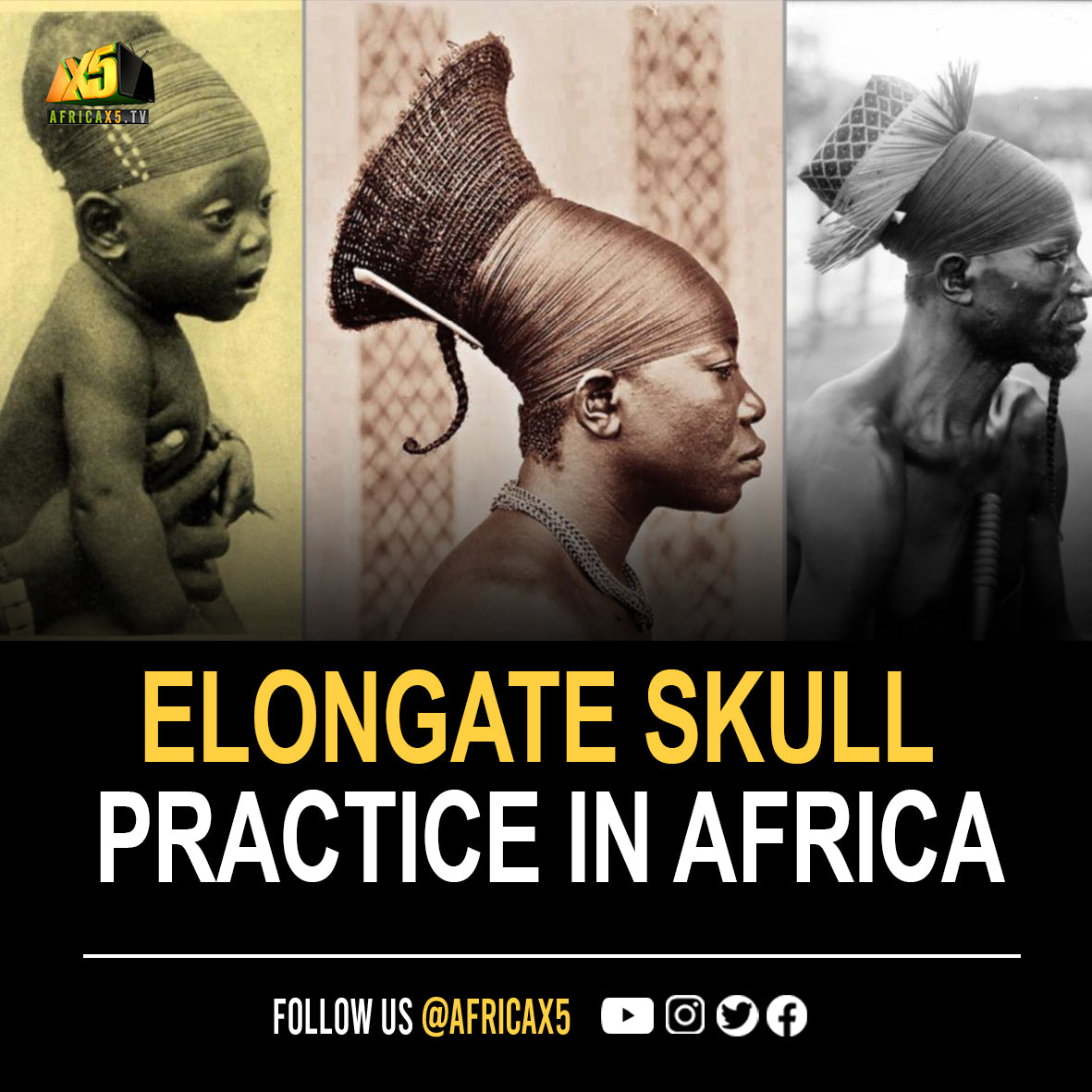 Elongated Skull practice in Africa – Made in Africa Brand